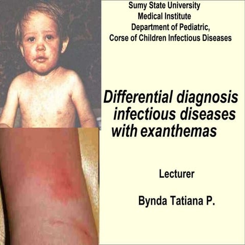 Exanthema_presentation infectionsdiseases.ppt
