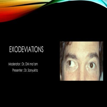 Alternative exodeviations case presentation... | PPT