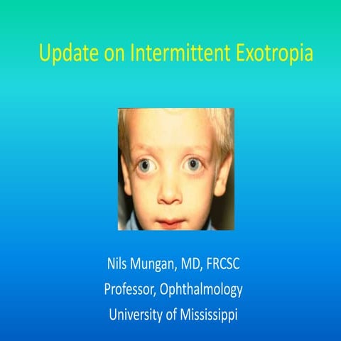 Intermittent exotropia | PPTX