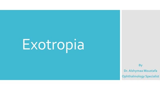 Exotropia | PPTX | Eye and Vision Conditions | Diseases and Conditions