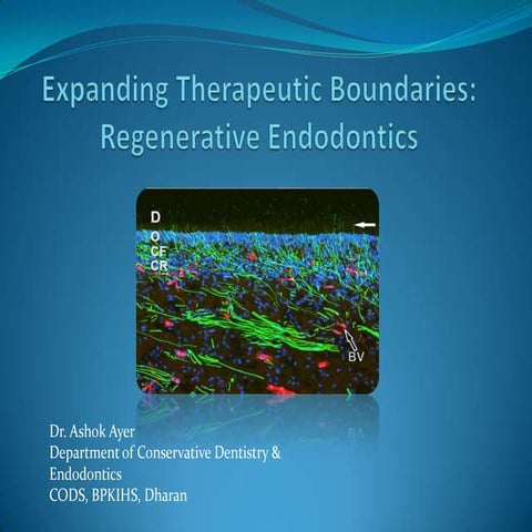 Expanding therapeutic boundaries: Regenerative Endodontics | PPTX