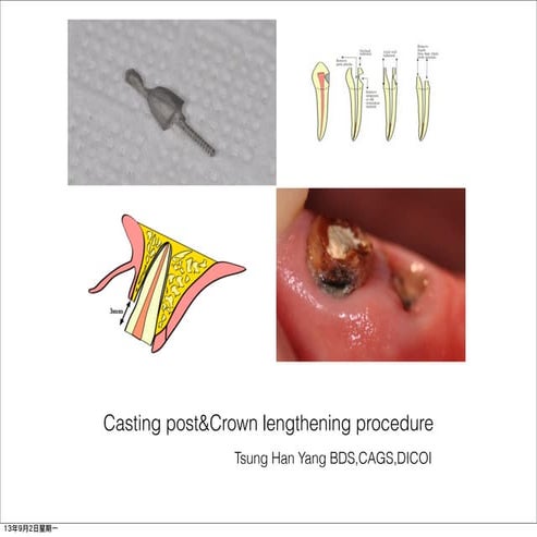 Experience sharing casting post&clp | PPT