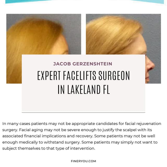 Expert Facelifts Surgeon in Lakeland FL.pdf