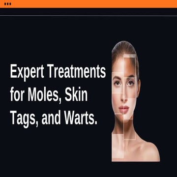 Expert Treatments for Moles, Skin Tags, and Warts..pdf