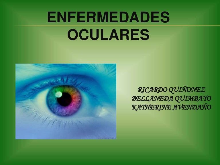Enfermedades Oculares