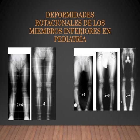PEDIATRIA DEFORMIDADES.pptx