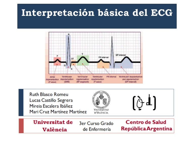 Como Interpretar Ecg - Catalog Library