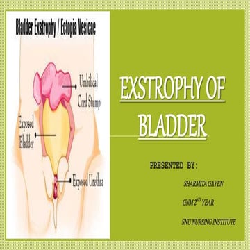 Exstrophy of bladder | PPTX
