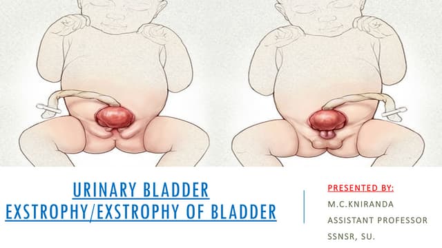 Exstrophy of bladder | PPTX