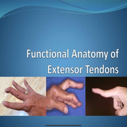 Extensor tendon injuries | PPT