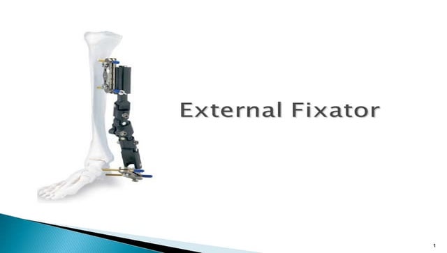 Principles of external fixator