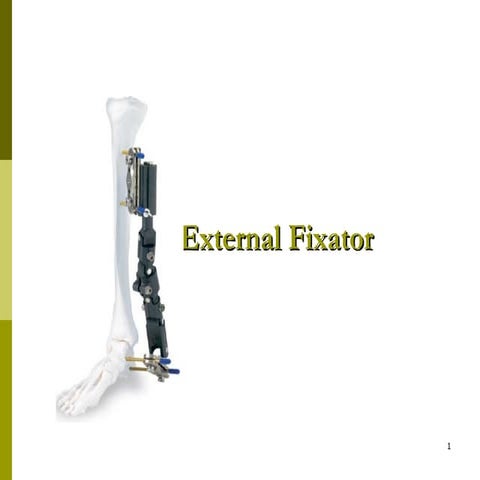 External fixator | PPT