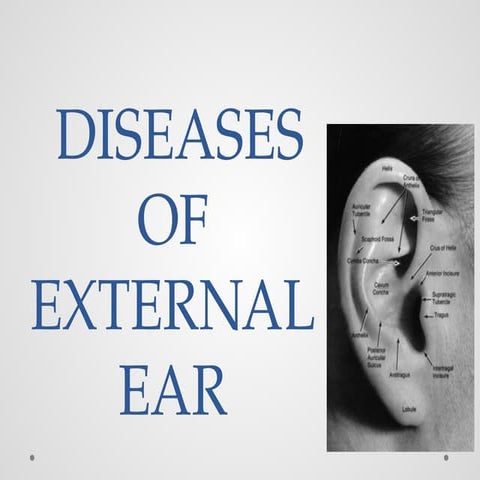 Diseases of external ear and its management | PPTX