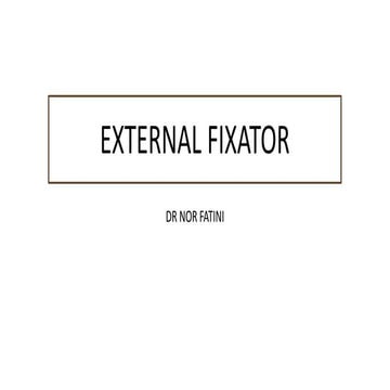 Principle of internal and external fixation slideshare | PPTX