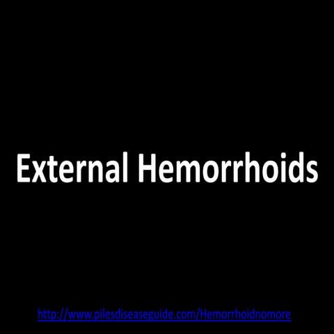 External hemorrhoids | PPT