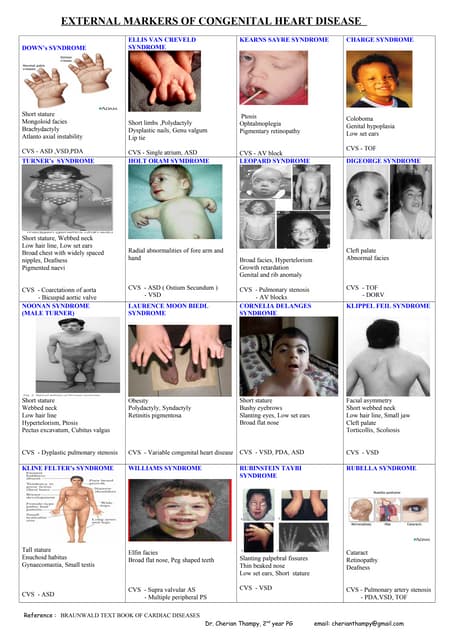 Harrison sulcus | PDF