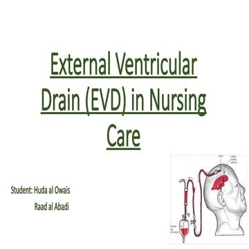 External Ventricular Drain | PPT
