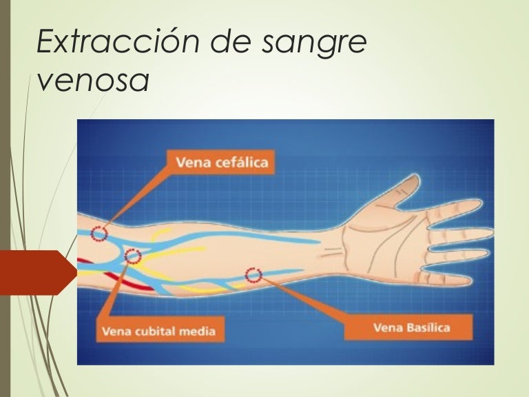 Extraccin de-sangre-venosa-1200769522732978-2
