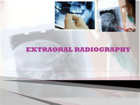 Xray views of skull1 | PPTX | Ear, Nose and Throat Conditions | Diseases and Conditions