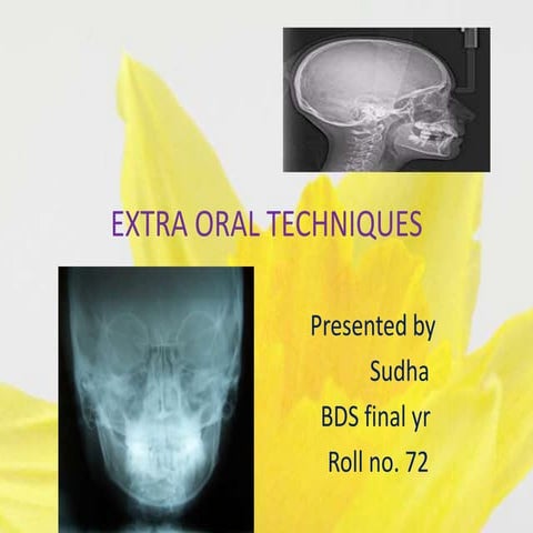 Extraoral radiography | PPT