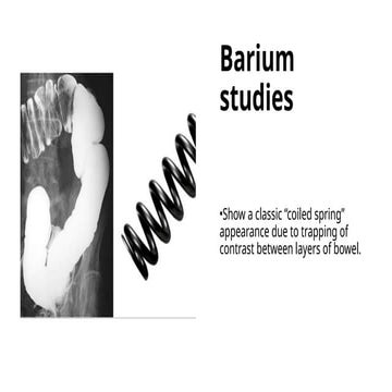 Extras for intussusception with barium .pptx