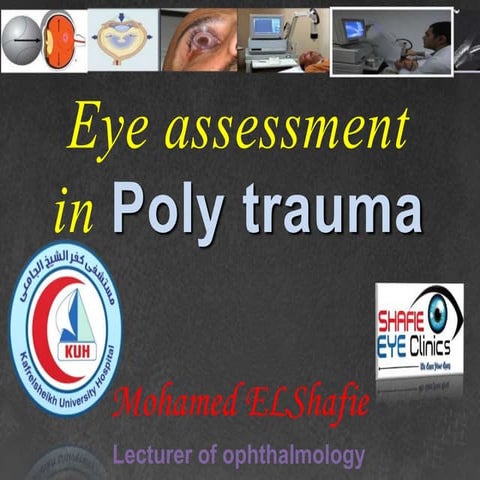 Eye trauma for Dentists | PPTX