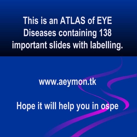 Eye atlas of disease (ayemon) | PPT