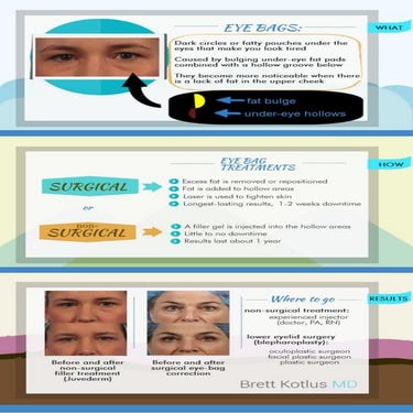 Eye bag treatments infographic | PDF