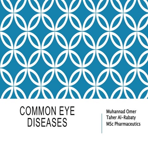 common eye diseases powerpoint presentation | PPTX