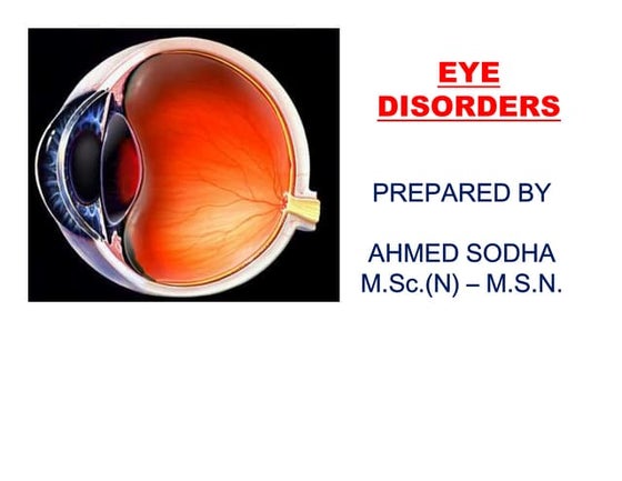 Disorders of the eye | PPT