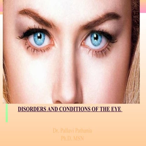 Eye diseases & disorders | PPT