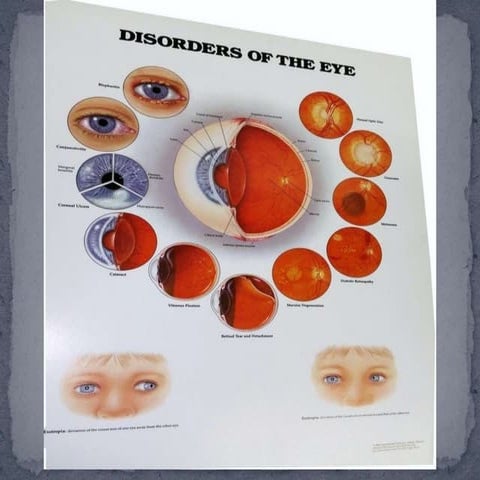 eye disorders .pptx