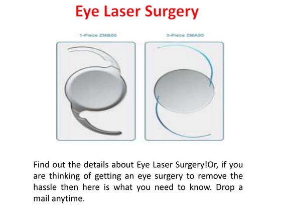 Eye Laser Surgery | PPTX