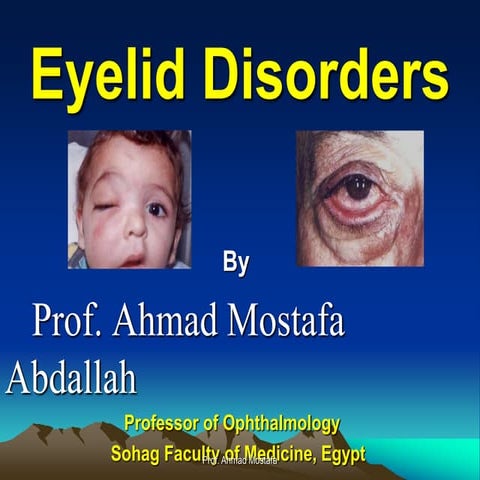 Eyelid disorders | PPT