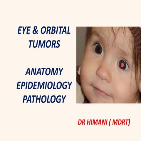 Eye & orbit tumors anatomy, epidemiology, pathology by himani | PPTX