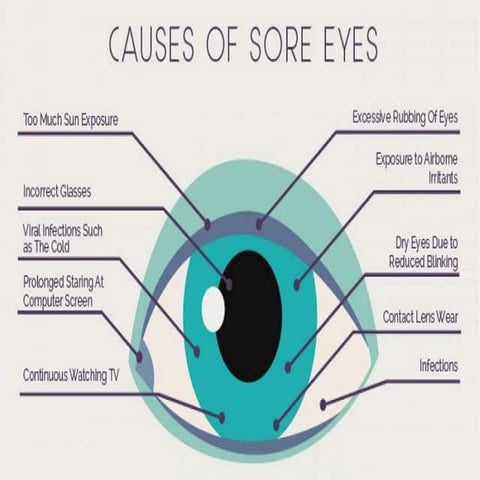 Simple Eye treatment at Home | PPTX