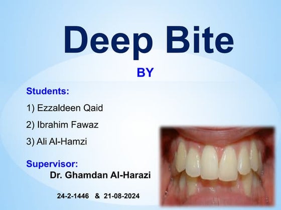 Curve of Spee in orthodontics and its effects | PDF | Dental Health | Diseases and Conditions