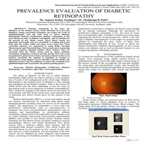 Automatic Detection of Diabetic Maculopathy from Fundus Images Using