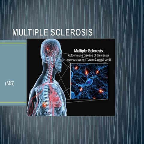 Understanding the Different Types of Multiple Sclerosis.pptx