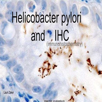 H. pylori | PPT