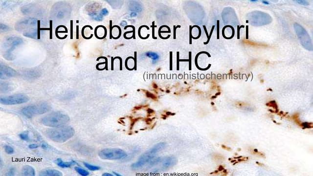 H. pylori | PPT