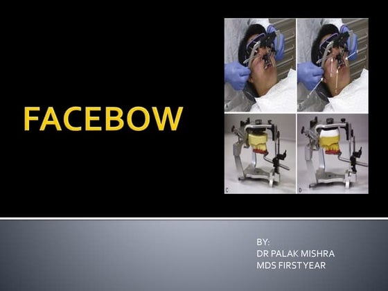 FACEBOW | PPT