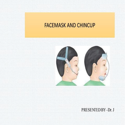 FACEMASK CHINCUP SEMINAR[1].pptx