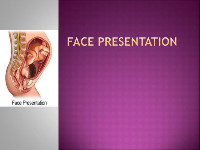 Malpresentation (face, brow) | PPTX