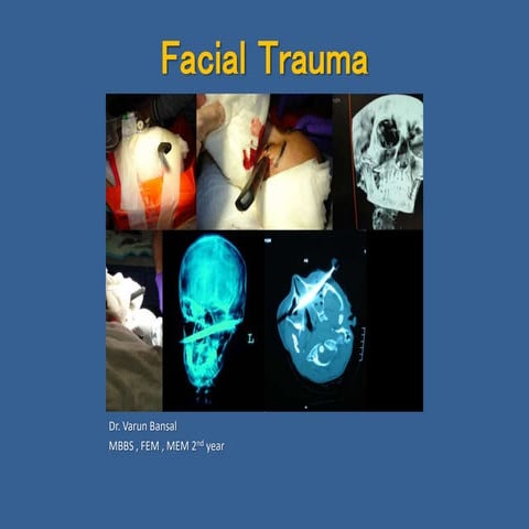 Facial-Trauma-Presentation.pptx
