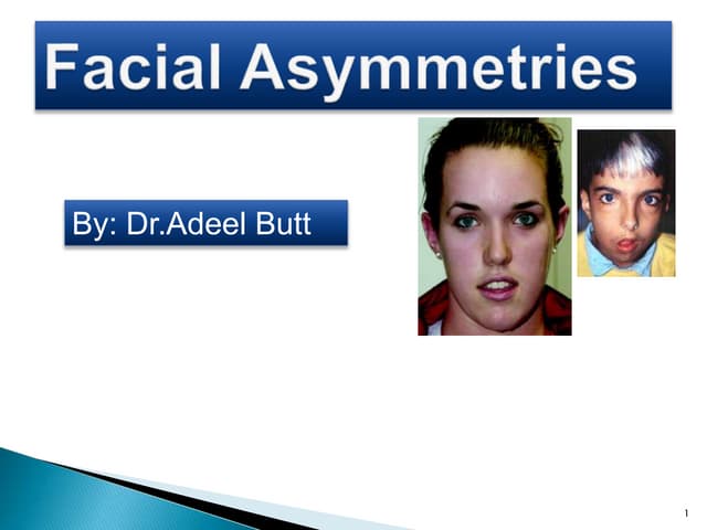 Facial nerve grading system used in facial paralysis | PDF