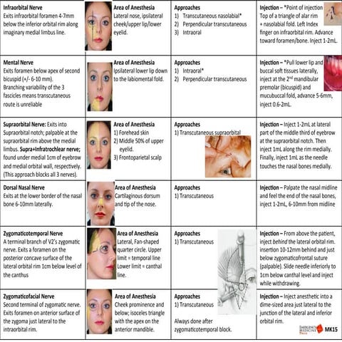 Facial blocks - Martin Kuuskne | PPT