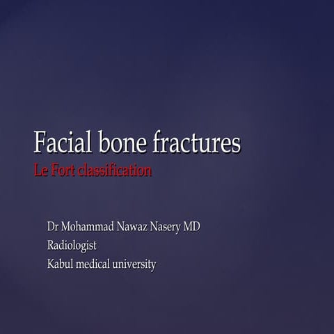 Facial bone fracture | PPT