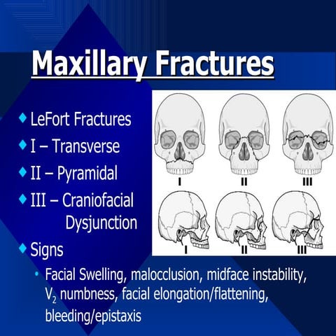 Types of Facial Injuries and Their indications for referrals | PPT