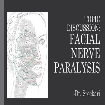 Facial Nerve Paralysis | PPT